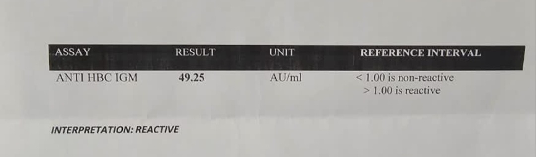 Acute hepatitis b - Just diagnosed or new to the community - Hep B ...